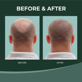 Thik&Fix Hair Growth Supplement ( 30 single-serve packets ) – Thik&Fix ...